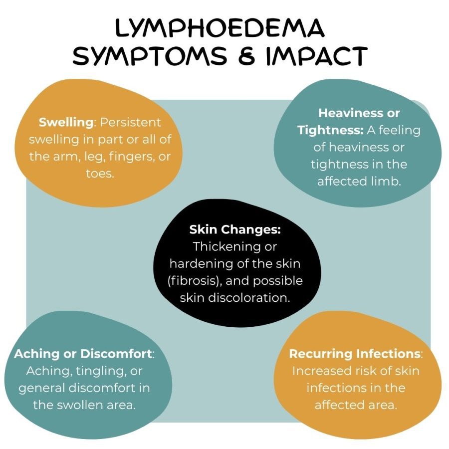 Essential Guide To Lymphoedema: What You Should Know Now