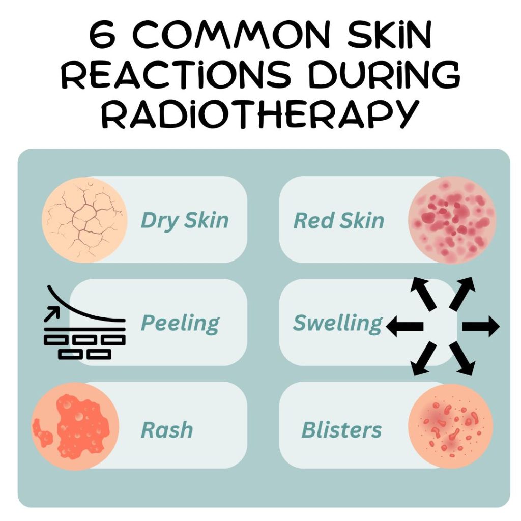Effective Skincare During Radiotherapy: Tips & Strategies
