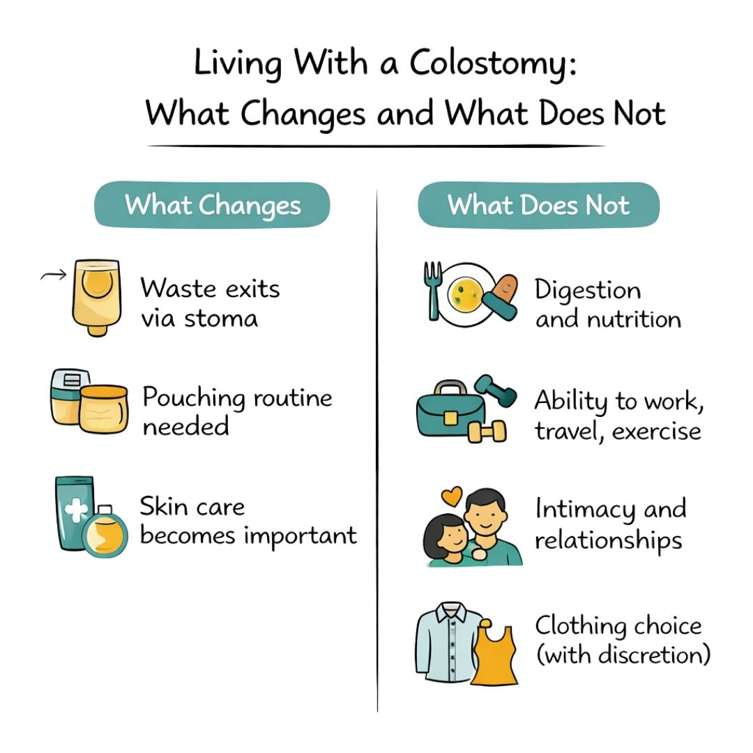 What Is A Colostomy And How Does It Work?